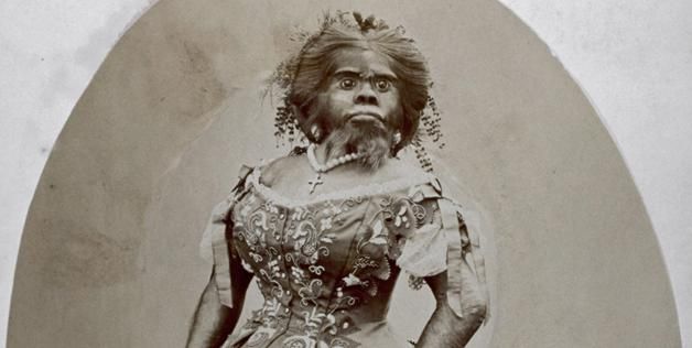 The Mysterious -and Sad- Case of Julia Pastrana, the ”Ape-Woman ...